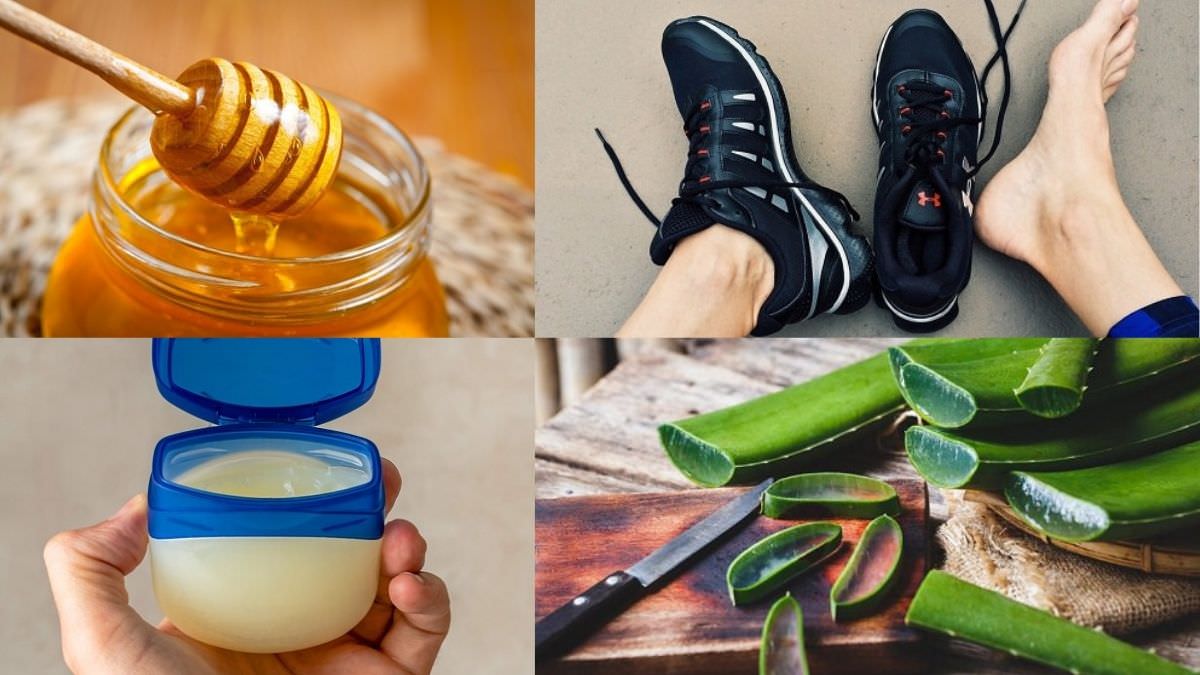 How to Heal A Shoe Bite | Shoe Bite Home Remedy ⋆ The Health Exchange