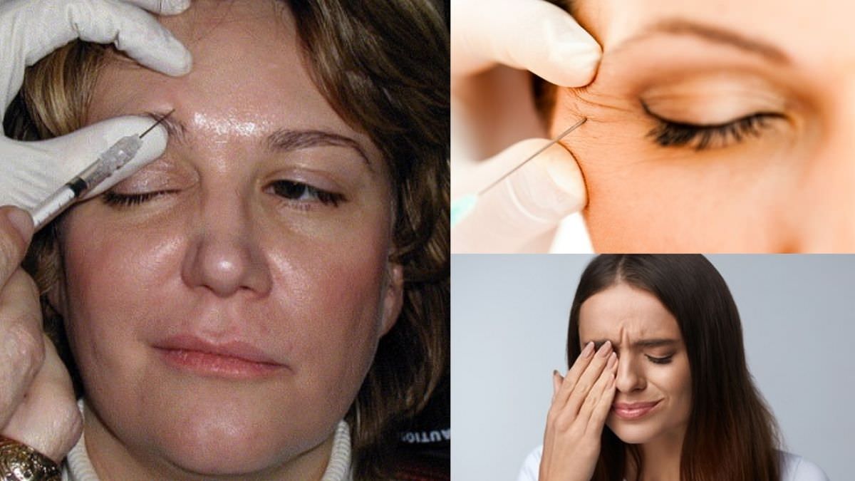 Side Effects of Botox Injections for Hemifacial Spasm ⋆ The Health Exchange